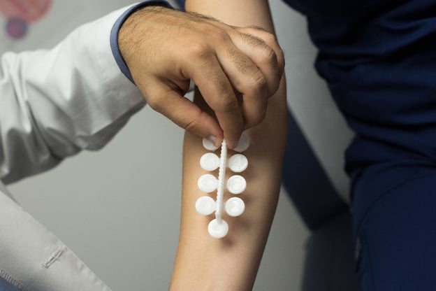 Allergy Testing and Treatment: 4 Things to Know About Having Your ...