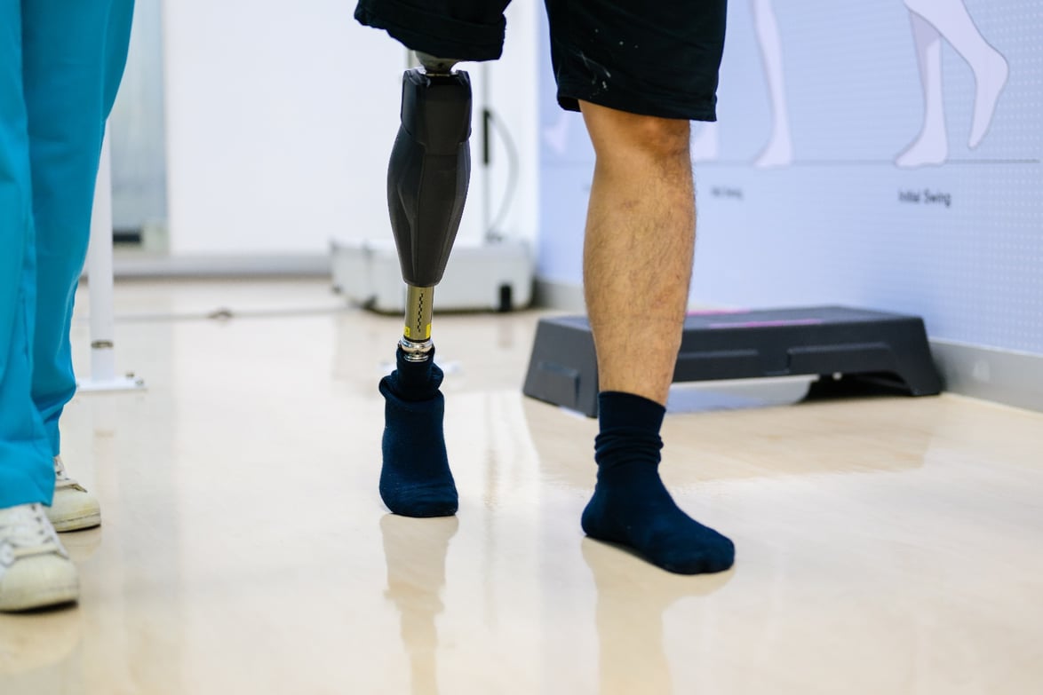 6 Benefits of Post-Prosthetic Rehabilitation