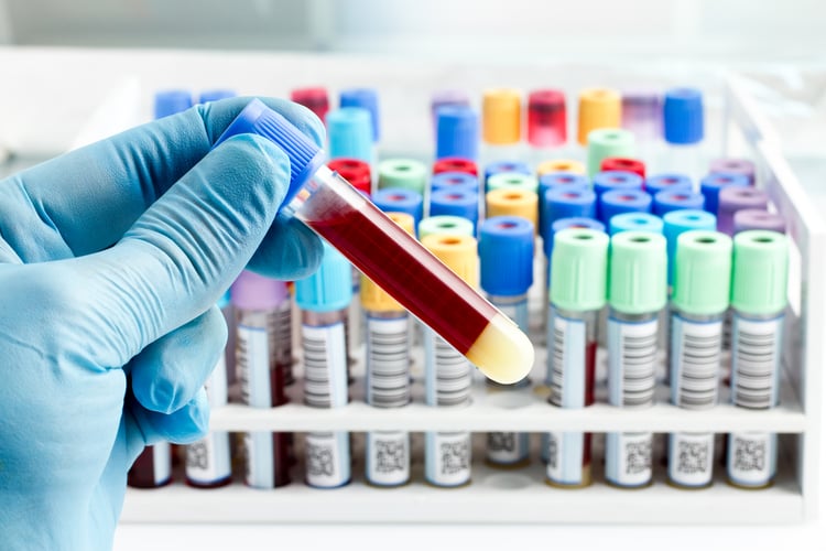 Laboratory Testing at Lane Regional Medical Center: Types of Blood Work
