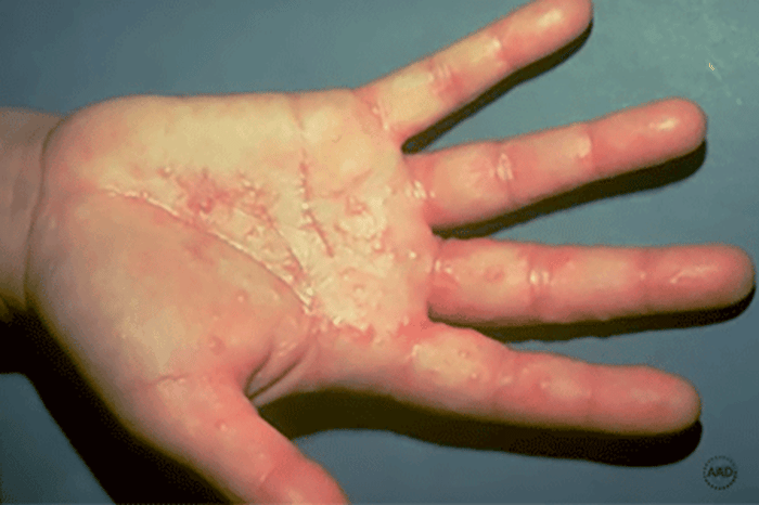 Dermatology Baton Rouge | Dermatology Zachary