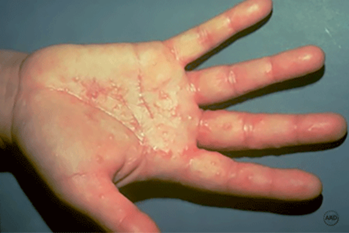 Dermatology Baton Rouge | Dermatology Zachary